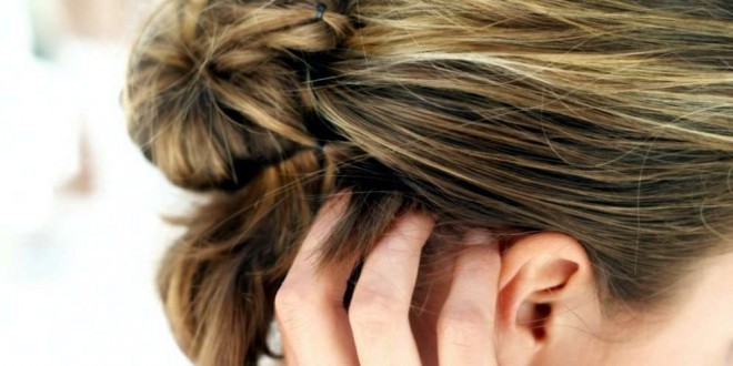 Forfora: cause, rimedi naturali e come eliminare la forfora